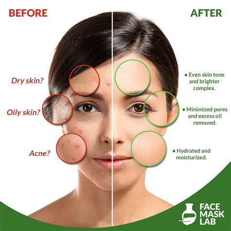 Skin Care Routine For Combination Skin And What Order To Apply