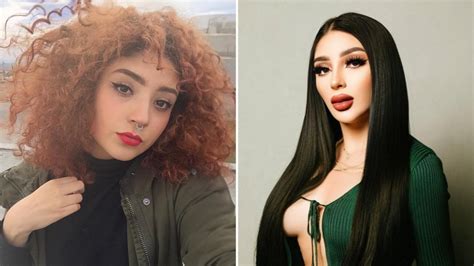 Cuántas cirugías estéticas tiene Bellakath Una la puso en peligro