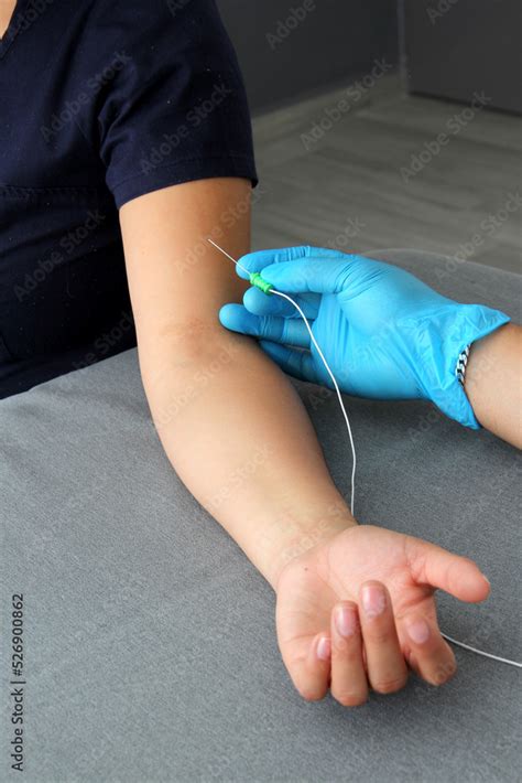 Electromyography Is A Graphic Recording Technique Of The Electrical
