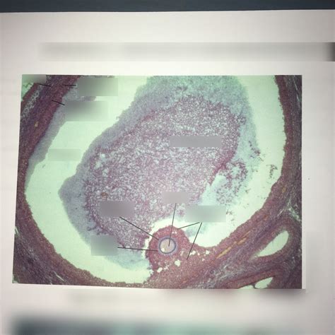 Mature Follicle Ovary Diagram Quizlet