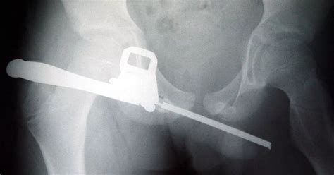 Bizarre X Rays Revealed Mirror Online