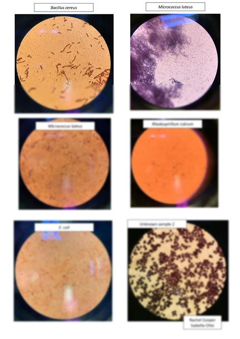 Micrococcus Luteus Gram Stain
