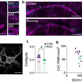 Stages Of Hippocampal Neurogenesis Depiction Of The Stages Of The