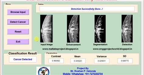 Breast Cancer Detection Using Neural Network Matlab Project Code