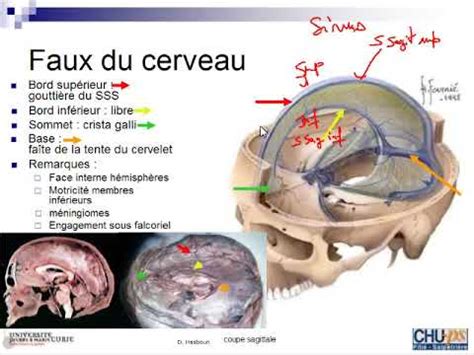 M Ninges Neuroanatomie Youtube