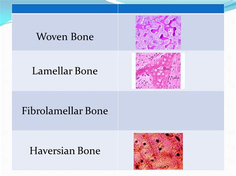 Chapter Bone Terminology Drift Growth Of One Surface Involves