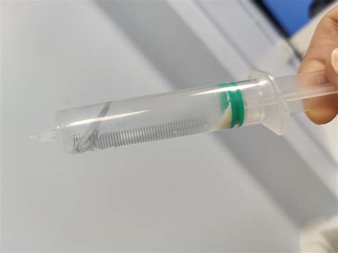 How Is Shoulder Barbotage Lavage Treating Calcific Tendonitis Done