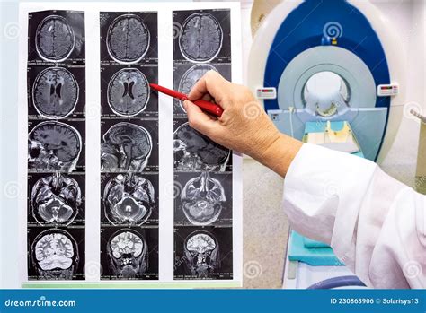Magnetic Resonance Image Or MRI Of The Brain Stock Photo Image Of