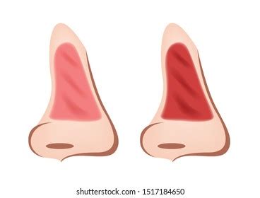462 Mucosa Nasal Images Stock Photos Vectors Shutterstock