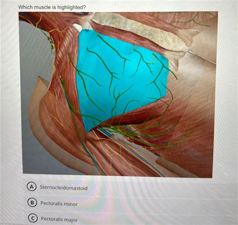 Which Muscle Is Highlighted Chegg