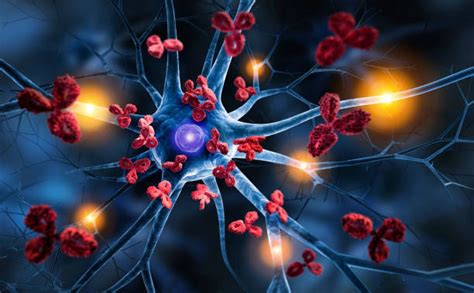Comprendre La Scl Rose En Plaques Sympt Mes Traitements Et