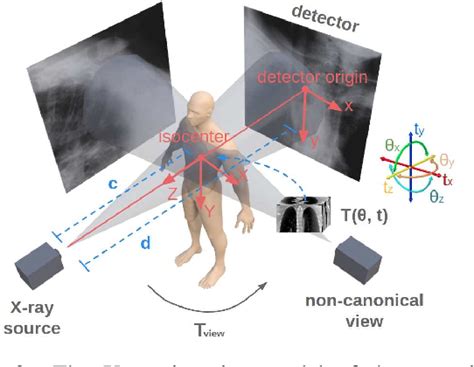 figure 2 from multiview 2d 3d rigid registration via a point of interest network for tracking