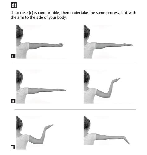 Cubital Tunnel Syndrome Swansea Bay University Health Board Cubital