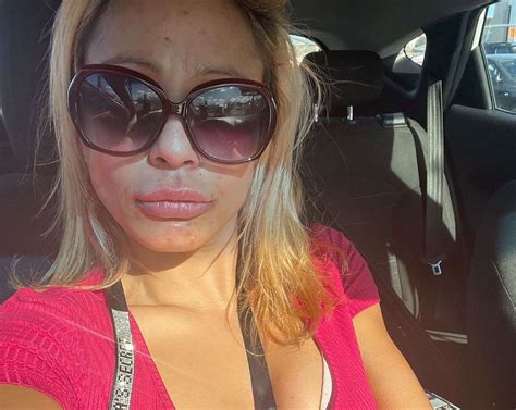Half Naked Herne Bay Woman Ran From Police In Margate After Crashing