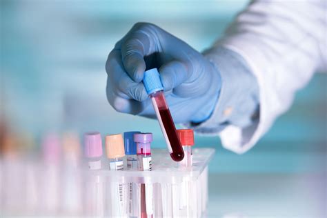 12 exames de sangue como entender o resultado Tua Saúde