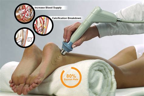 TENDINITE DO CALCÂNEO Fisioterapia
