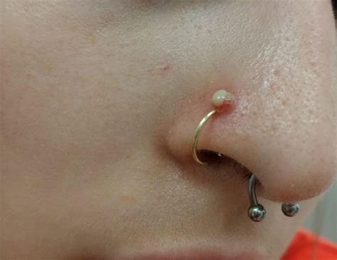 Piercing Nose Infection In Nose Piercing Infection Nose