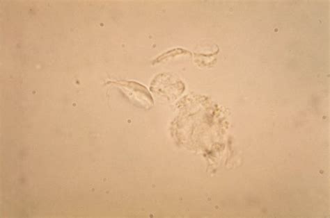 Kostenlose Bild Mikrophotographie Giardia Lamblia Trophozoiten