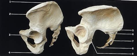 Male Left And Female Right Pelvis Lateral View Diagram Quizlet