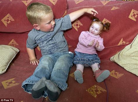 Smallest Girl In The World Due To Primordial Dwarfism