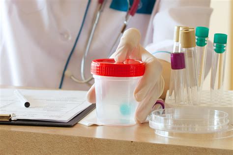 Análisis de orina MedlinePlus en español