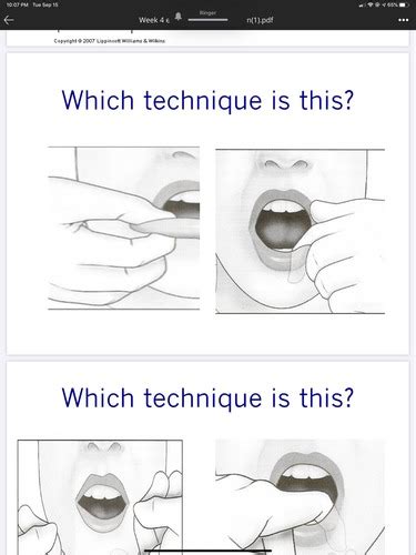 Extra And Intra Oral Exams Flashcards Quizlet