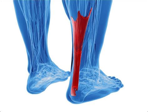 Rupture Partielle Du Tendon D Achille Les Signes
