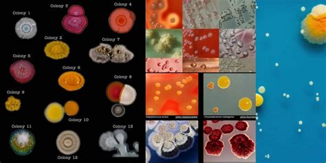 Colony Morphology Of Bacteria And Examples F8C Bacteria Morphology