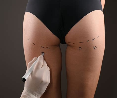 Augmentation Des Fesses Duty Clinic