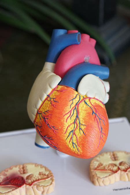 Coronary Artery Disease Cad Physiopedia
