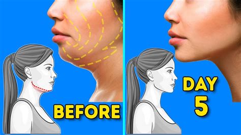Double Chin Fat And Face Lift 5 Days Face Workout Youtube