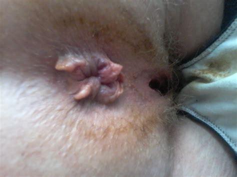 Hairycurvydirty Hairy Dirty Outie Anus