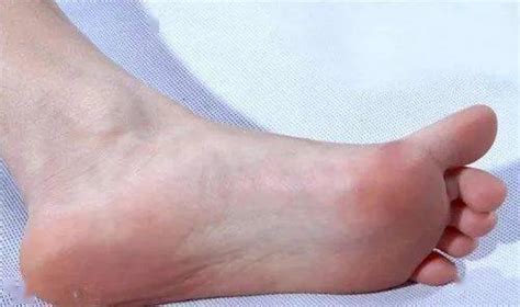 女人壽命長不長看腳就知曉腳上有5個特徵壽命短不了 趣味事務所