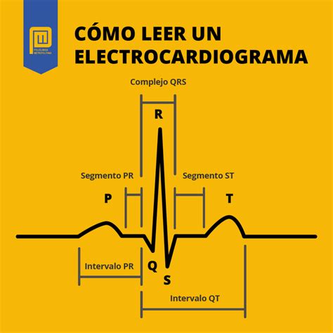 Papel Del Electrocardiograma Como Leer Un Ekg Paso A Paso NBKomputer
