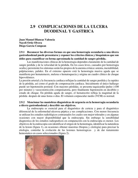 Glosario conspiración acantilado diagnostico de ulcera peptica