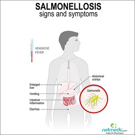 Salmonellosis Causes Symptoms And Treatment Netmeds