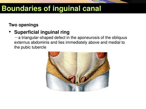 PPT Landmarks For Inguinal Ligament PowerPoint Presentation Free