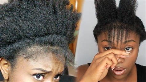 Thin No Edges Hairstyles 14 Extraordinary Alopecia Camouflage