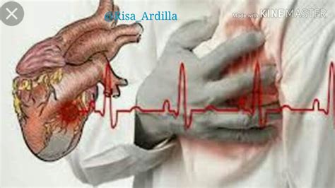 Arti Kedutan Pada Jantung Penyebab Gejala Dan Pengobatan Simbol Co Id
