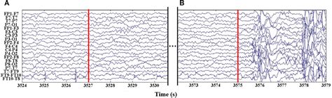 frontiers automatic epileptic seizure detection based on persistent homology