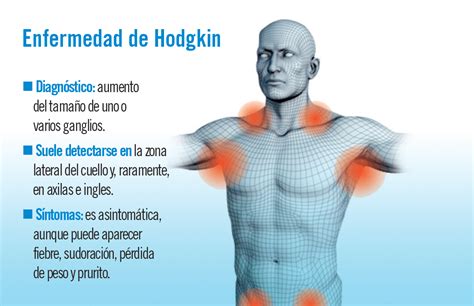 Linfoma de Hodgkin diagnóstico y tratamiento