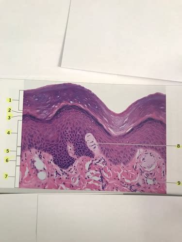 Epidermis And Dermis Of Thick Skin Longitudinal Section X