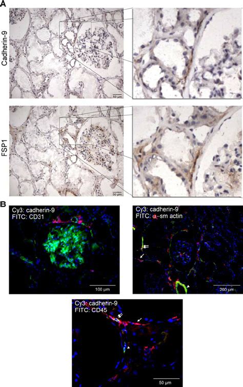 Cadherin 9 Is A Marker For Renal Fibroblasts A Immunohistochemical