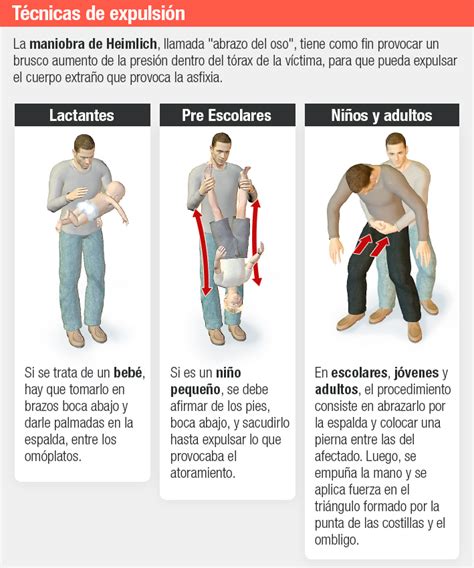 Maniobra de Heimlich Cómo realizar la técnica que puede salvar vidas