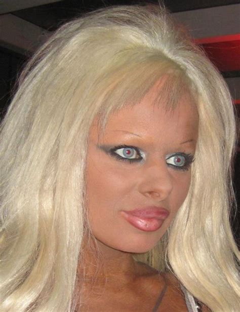 22 Plastic Surgeries Gone Way Wrong Eww Gallery EBaum S World