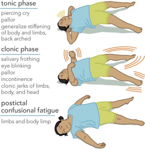 Peds Week 5 Neurologic Neuromuscular Week 6 Flashcards Quizlet