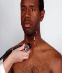Peripheral Vascular Exam Flashcards Quizlet