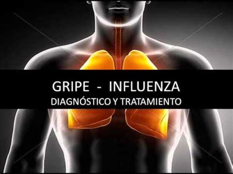 Gripe Influenza Diagnóstico y tratamiento YouTube
