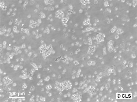Jurkat E Cells