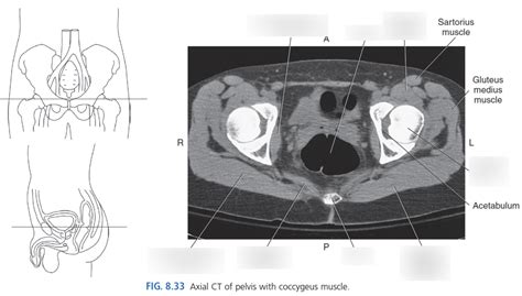 Pelvic Floor Muscles Anatomy Ct Review Home Co